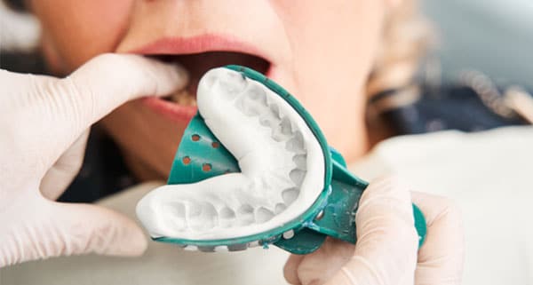 Clear Braces in St. Catharines | Martindale Dental