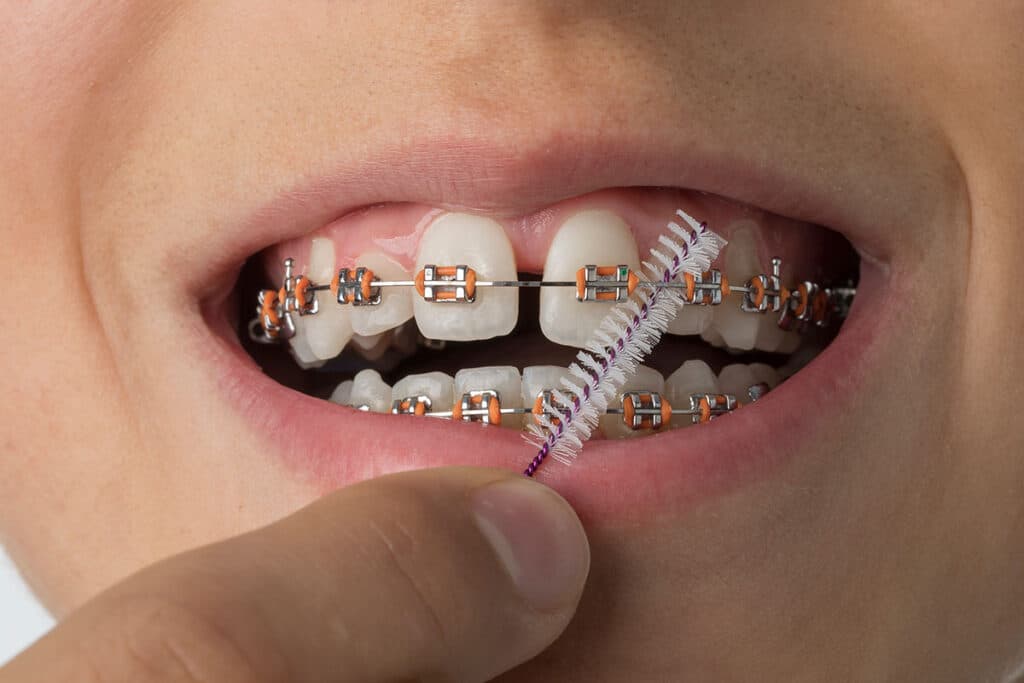 How to floss properly: Everything you need to know