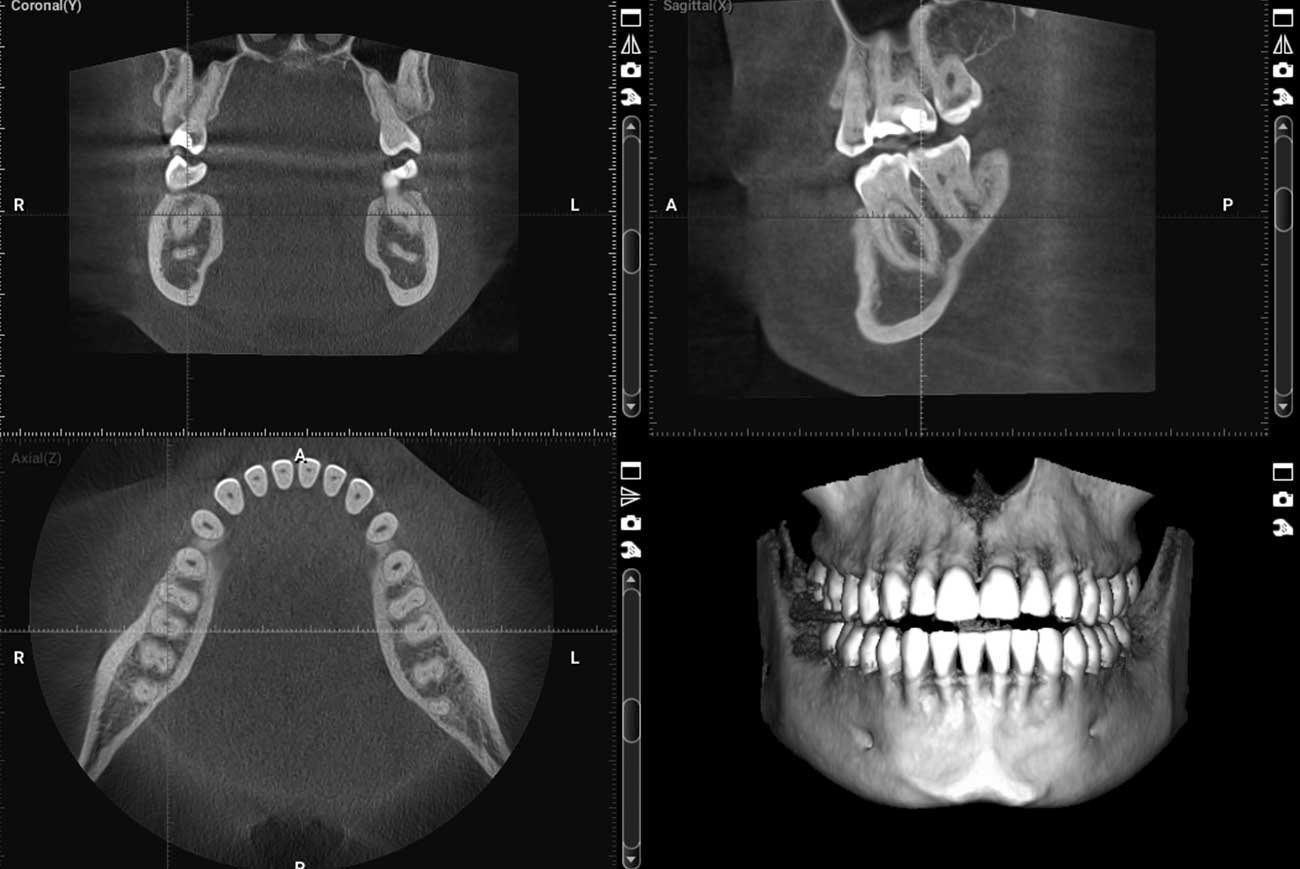 Dental X-Rays - Martindale Dental