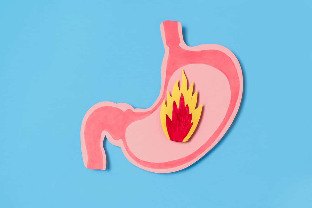 How Does Acid Reflux Affect Your Teeth? 5 Key Impacts - Martindale Dental