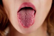 Understanding The Role of Saliva in Oral Health - Martindale Dental